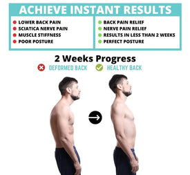 Back Hero - Brace and Posture Corrector – Spine Cracker